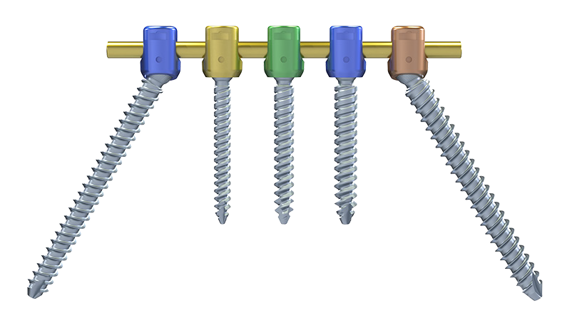 Momentum® - Posterior Spinal Fixation System