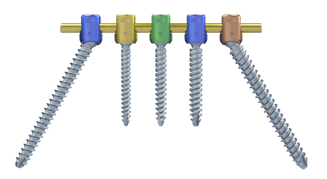 Posterior Spinal Fixation System